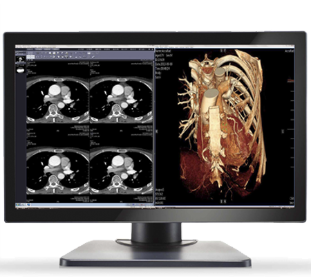 Medical Displays & Monitors - PACS, Mammo, Radiology, Ergonomics