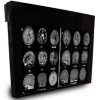 Medical Displays & Monitors - PACS, Mammo, Radiology, Ergonomics