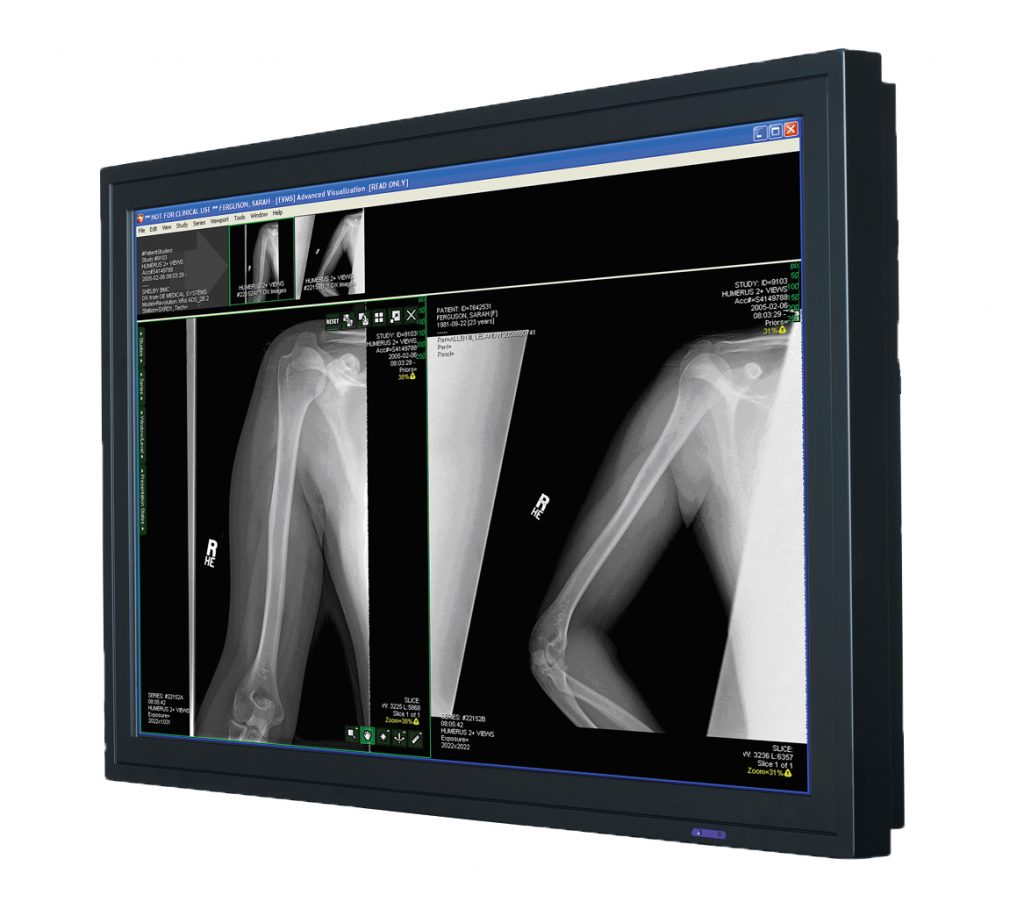 Surgical & Operating Room Monitors | Double Black Imaging