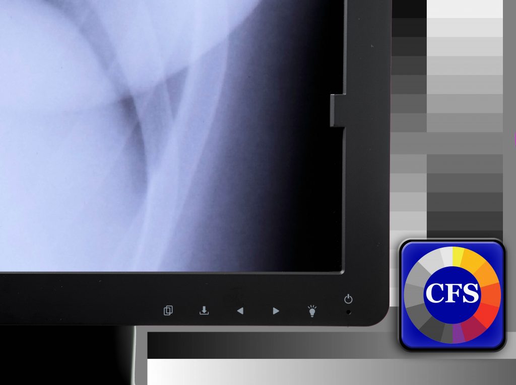 Medical Displays & Monitors - PACS, Mammo, Radiology, Ergonomics