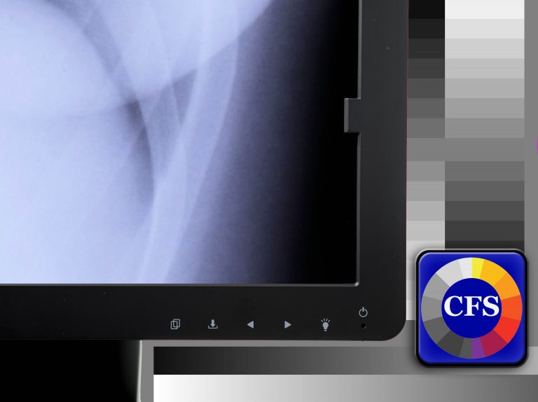 Medical Displays & Monitors - PACS, Mammo, Radiology, Ergonomics