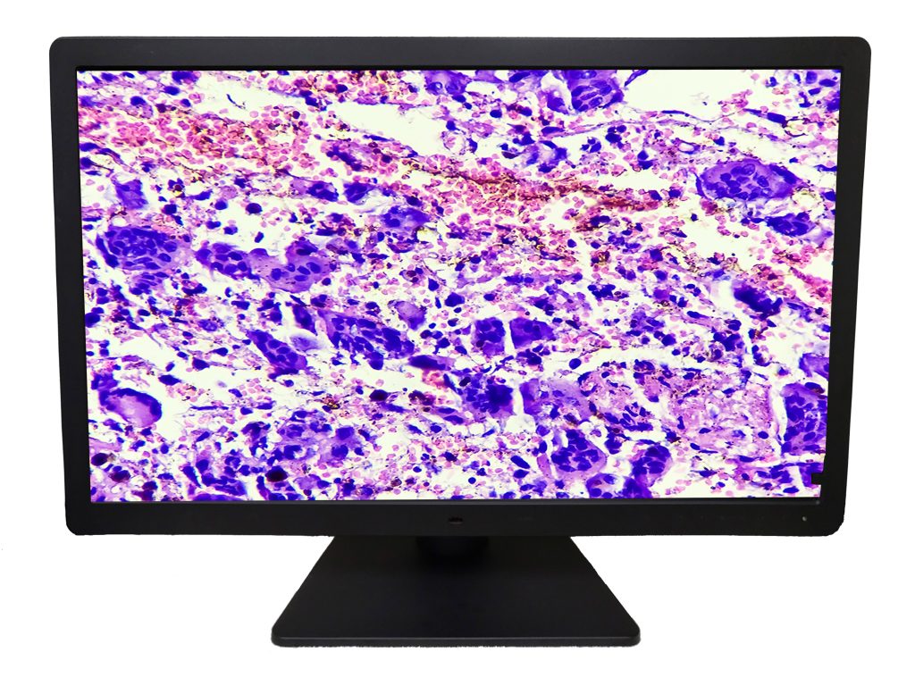 Medical Monitors & Displays | Double Black Imaging