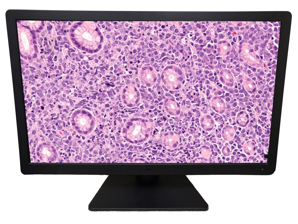 Digital Pathology Displays for Whole Slide Imaging